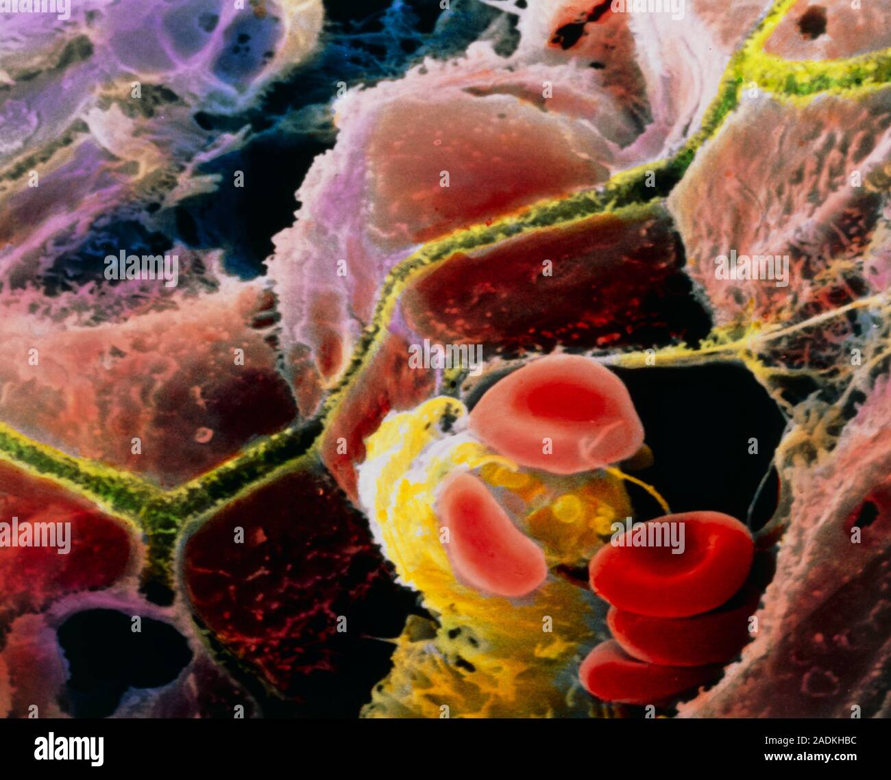Leberzellen. Farbige rasterelektronenmikroskopische Aufnahme von ...