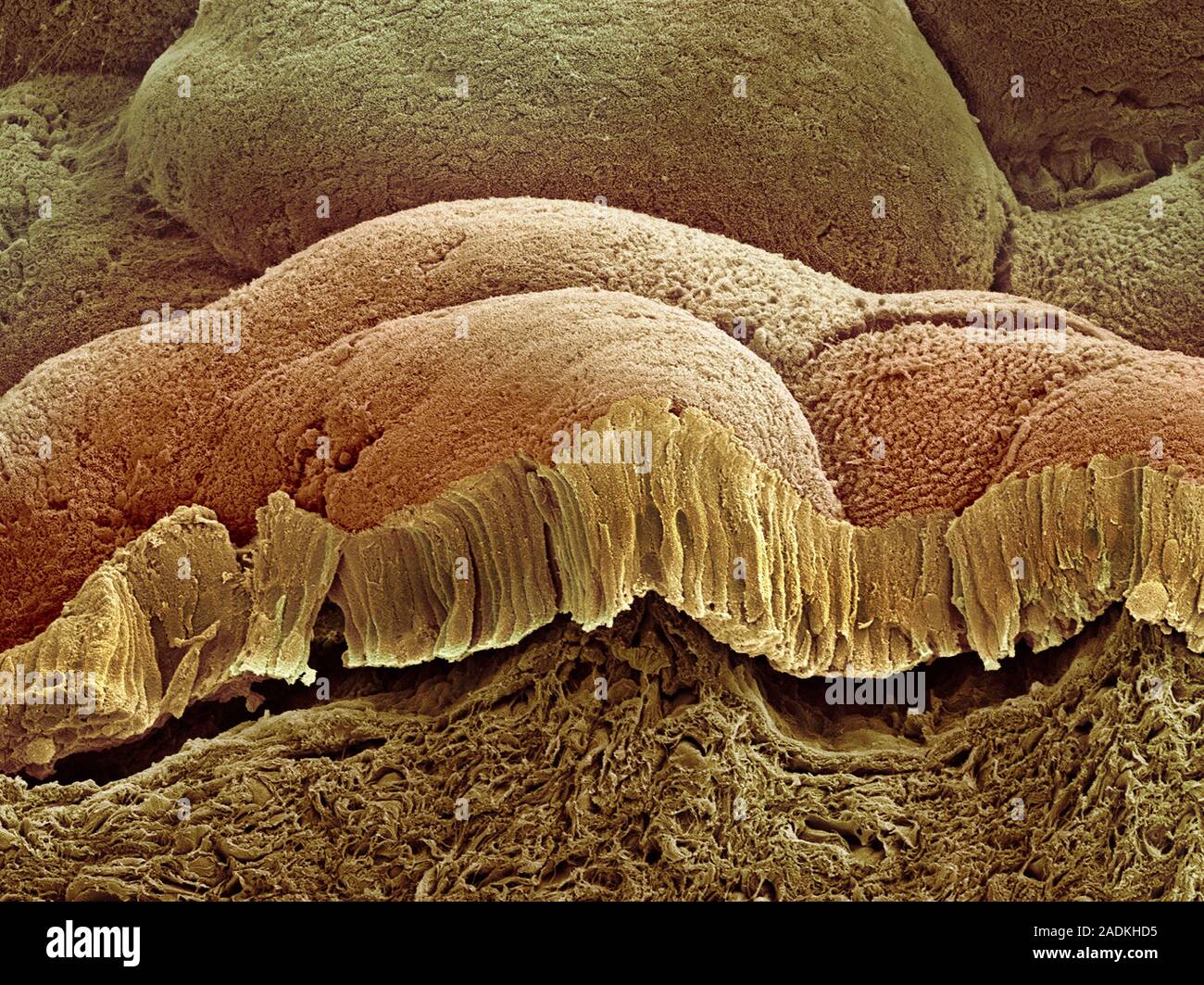 Gallengang. Farbige Scanning Electron Micrograph (SEM) von einem ...