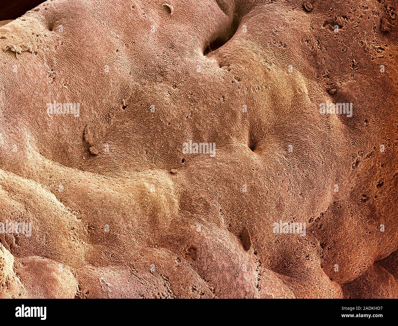 Gallengang. Farbige Scanning Electron Micrograph (SEM) der Oberfläche ...