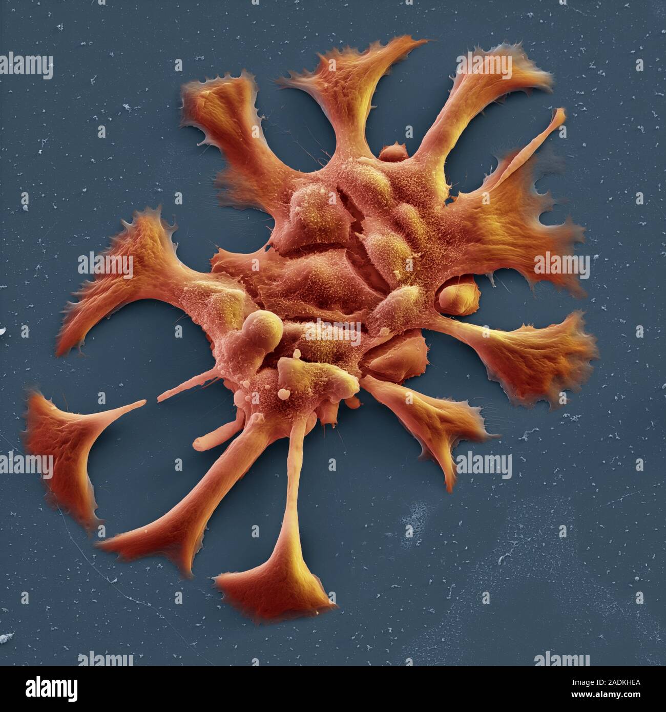 Leberzellen, farbige Scanning Electron Micrograph. Leberzellen, oder ...