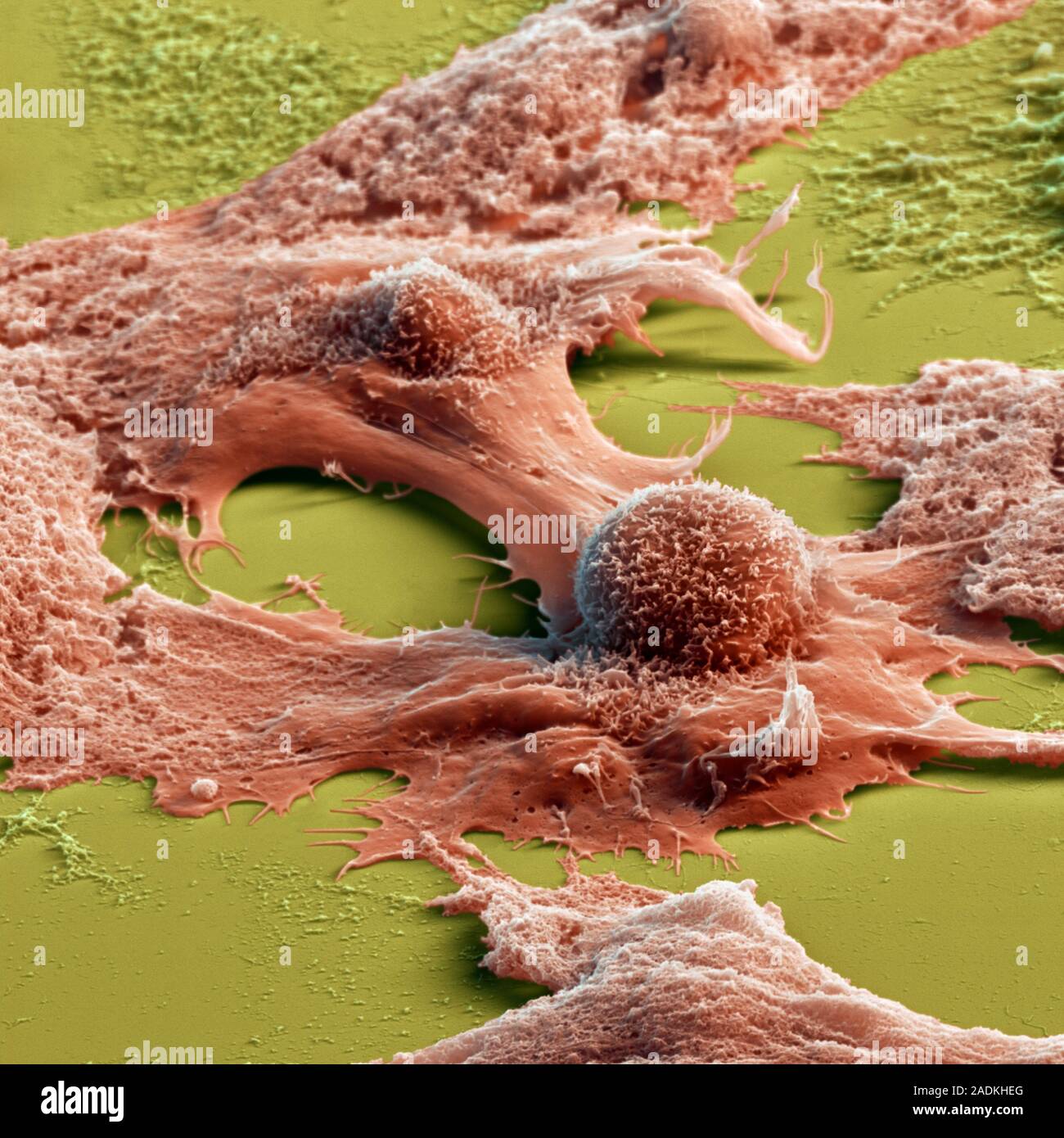 Leberzellen, farbige Scanning Electron Micrograph. Leberzellen, oder ...