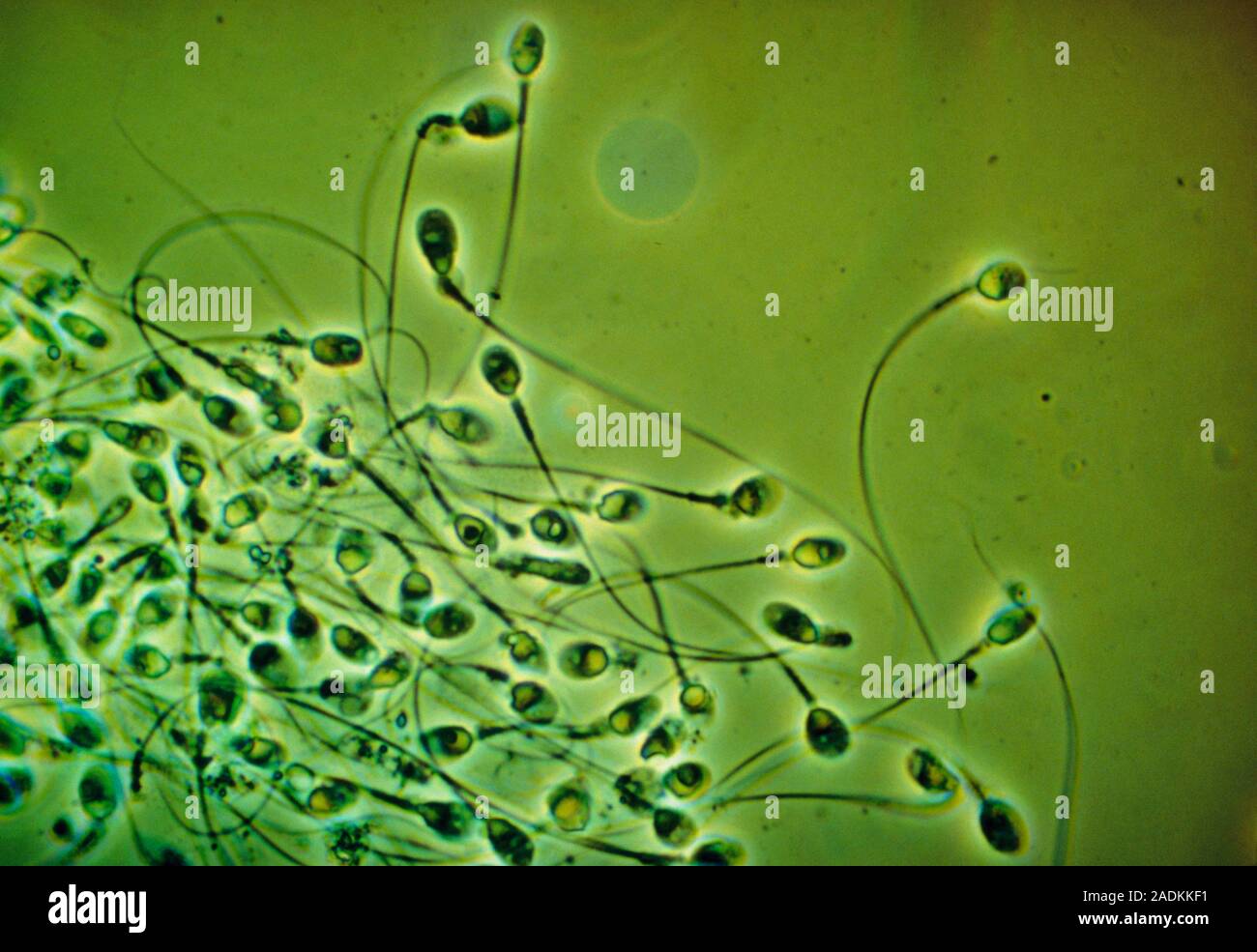 Licht Schliffbild einer menschlichen Samenzelle (spermium). Die ...