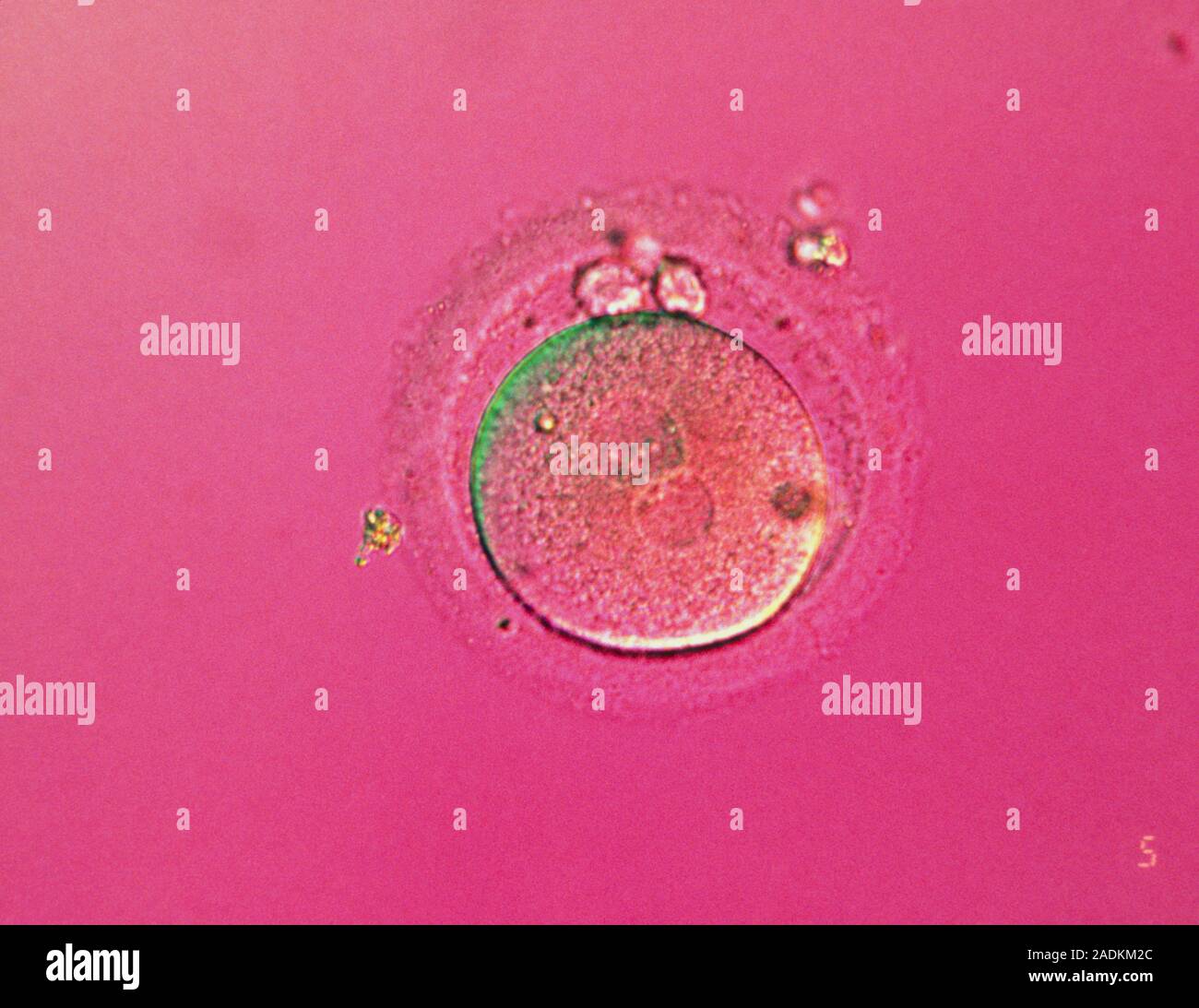 Der Befruchtung. Licht Schliffbild einer menschlichen Zygote zum ...