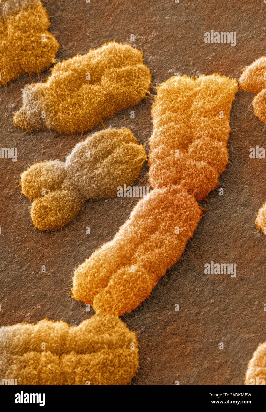 Menschliche Chromosomen. Farbige Scanning Electron Micrograph (SEM ...
