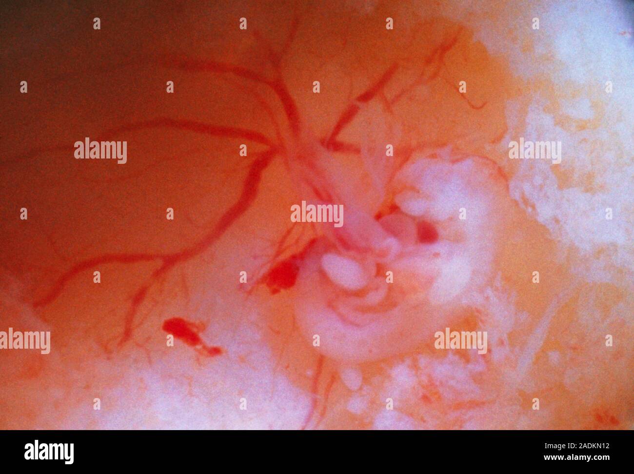 Der menschliche Embryo bei rund 4 Wochen, den Bauchnabel & Blutgefäße ...