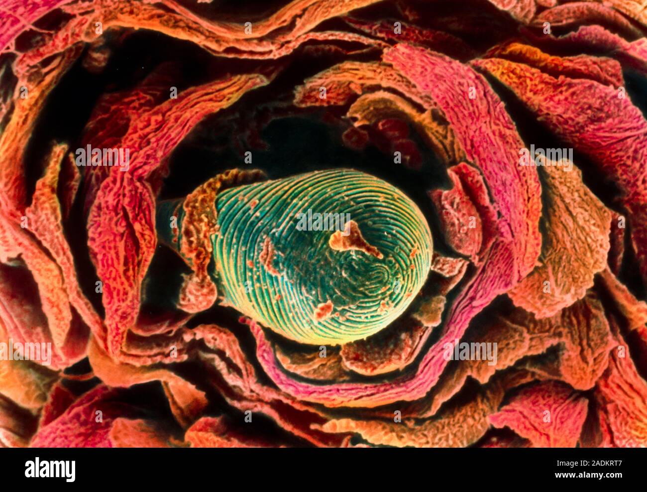 Haarschaft. Farbige Scanning Electron Micrograph (SEM) eines Haares ...