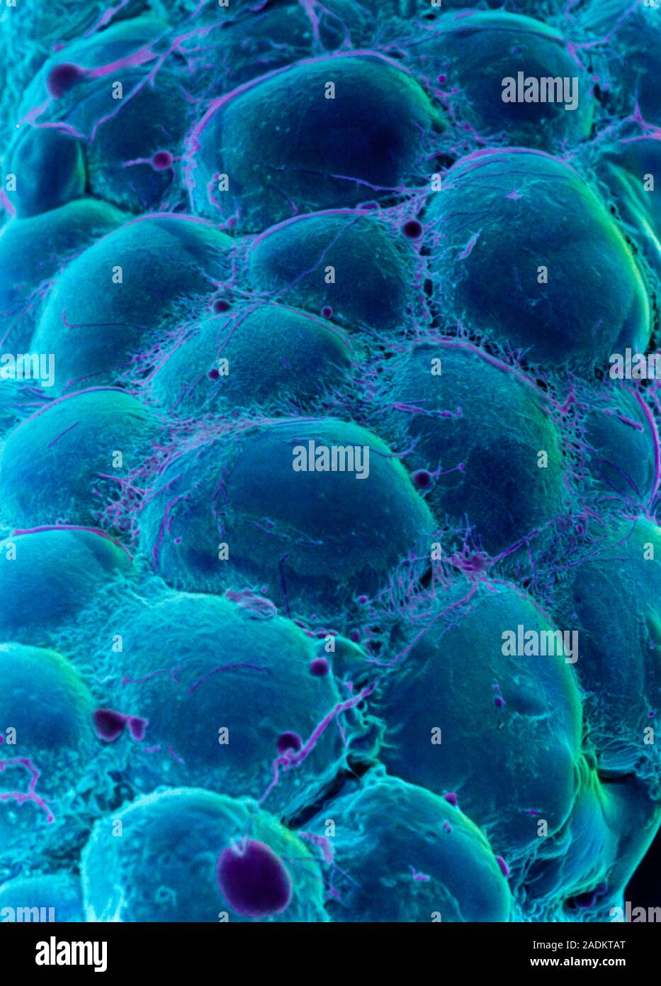 Fettgewebe. Farbige Scanning Electron Micrograph (SEM) Der große ...