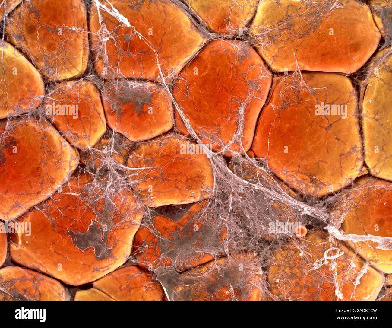 Fettzellen. Farbige Scanning Electron Micrograph (SEM) in den ...