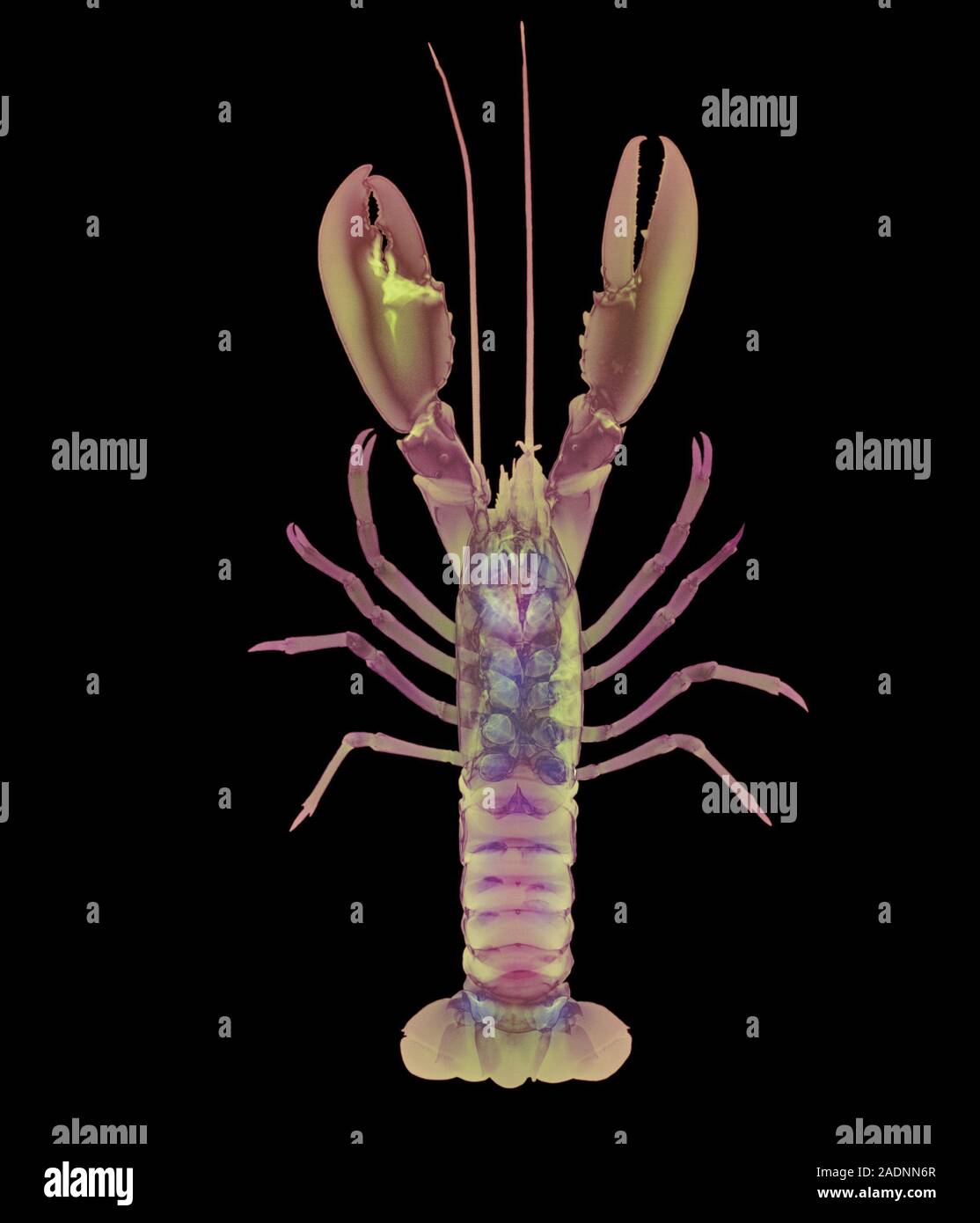 Hummer. Farbige X-ray von Hummer (Ordnung Decapoda). Diese marine ...