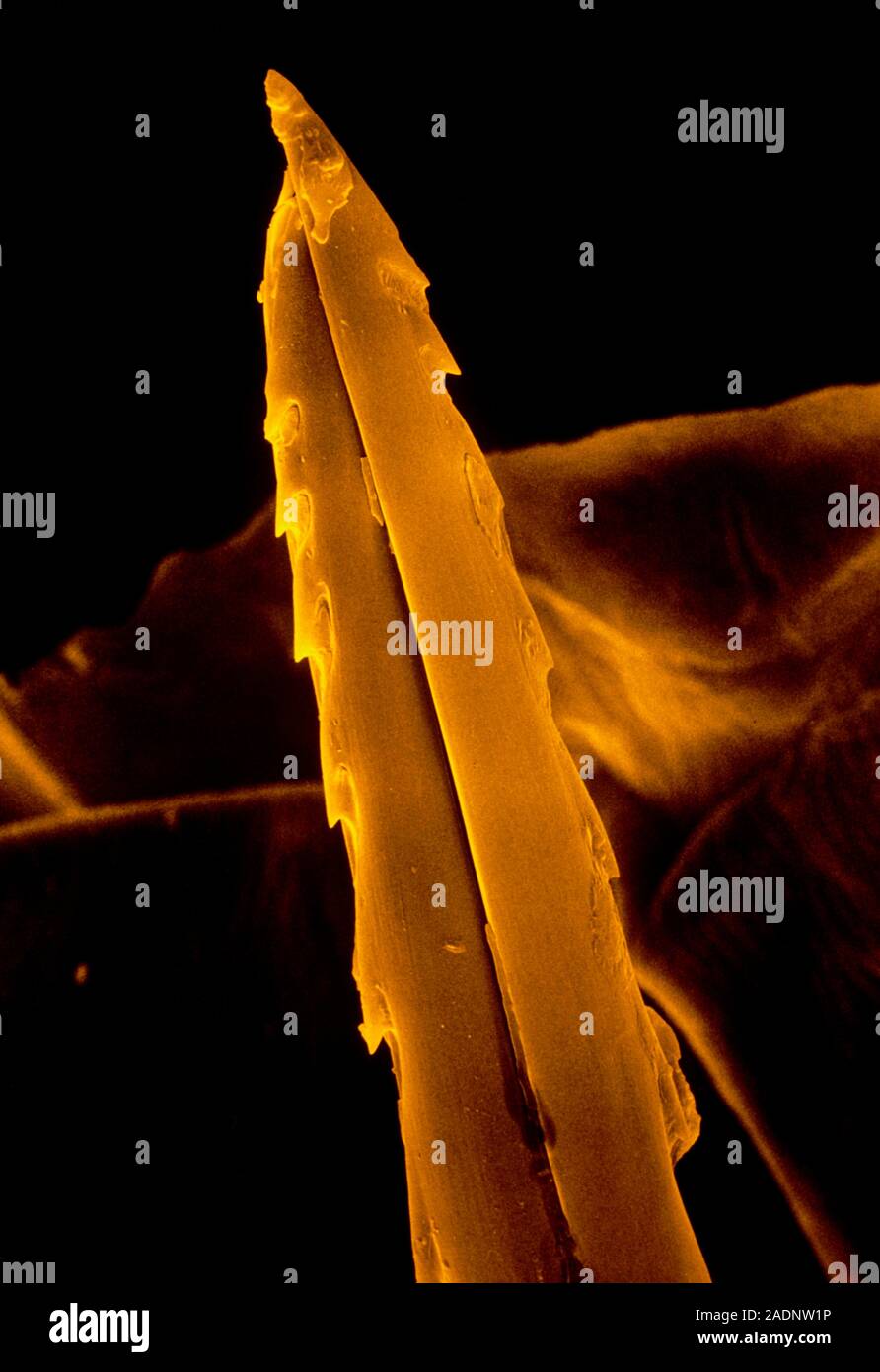 False - color Scanning Electron Micrograph des hinteren Ende einer ...