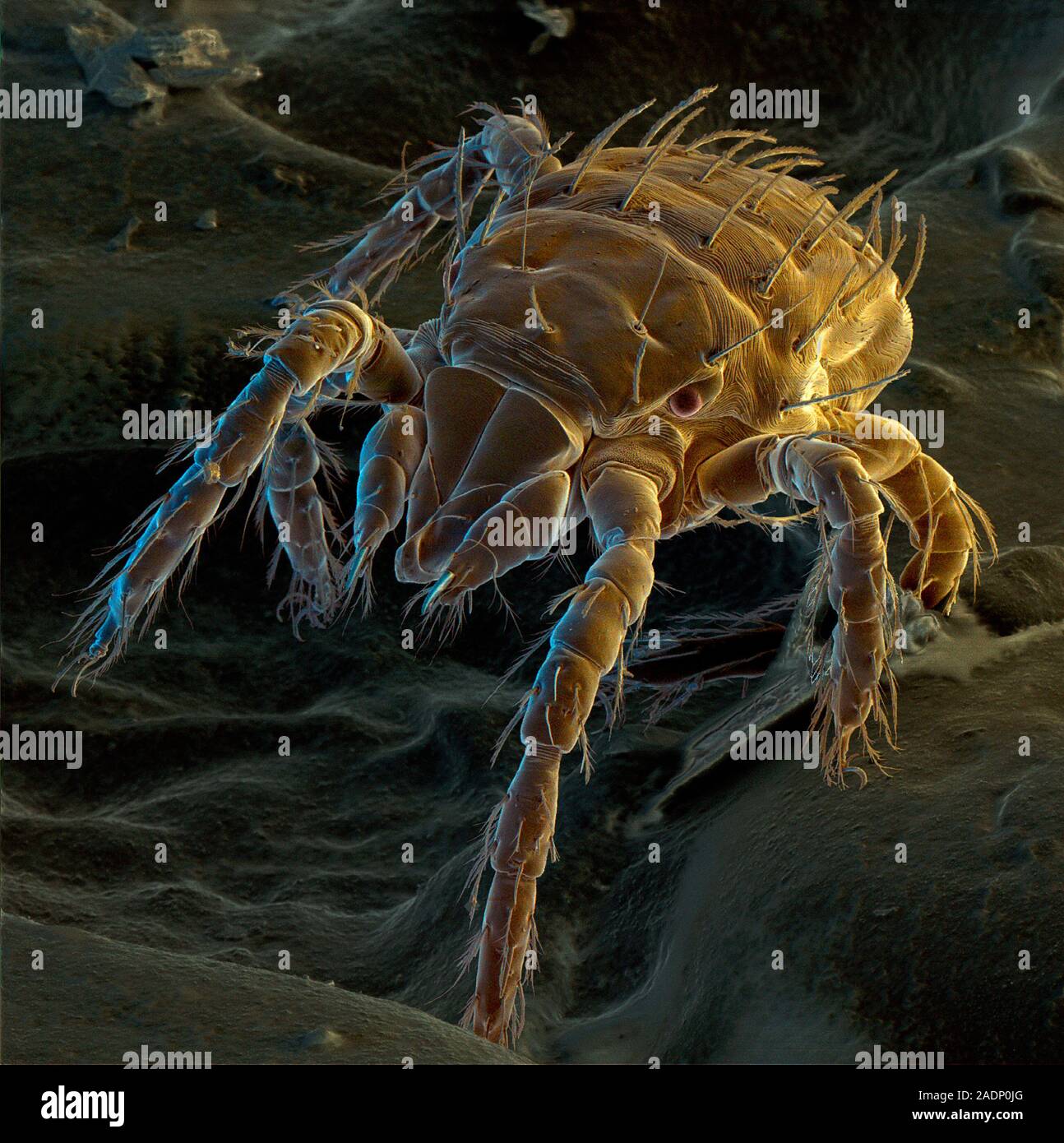 Chigger milbe. Farbige Scanning Electron Micro-Graph (SEM) Der Chigger ...