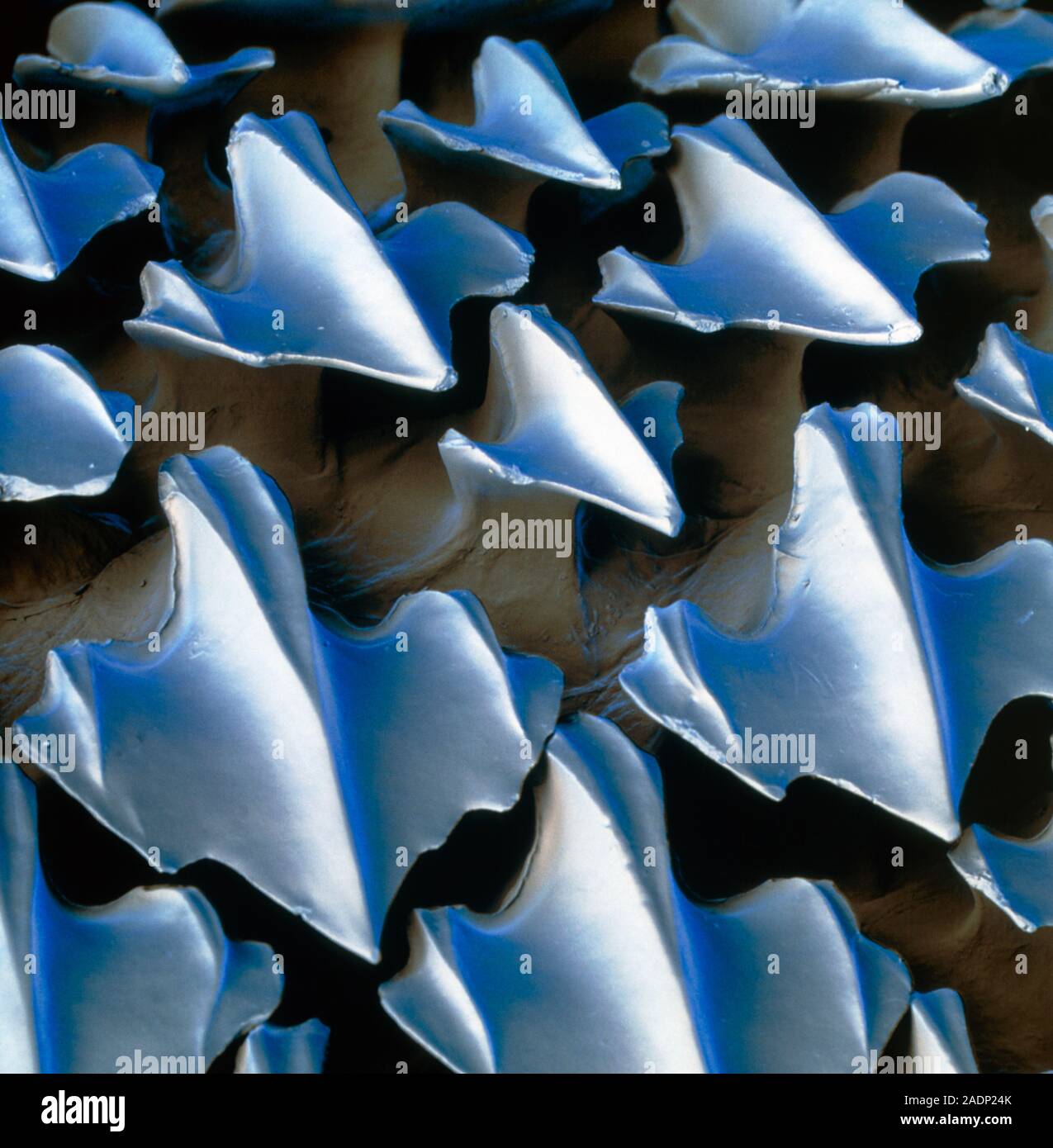 Shark Skalen. Farbige Scanning Electron Micrograph (SEM) der Schuppen ...