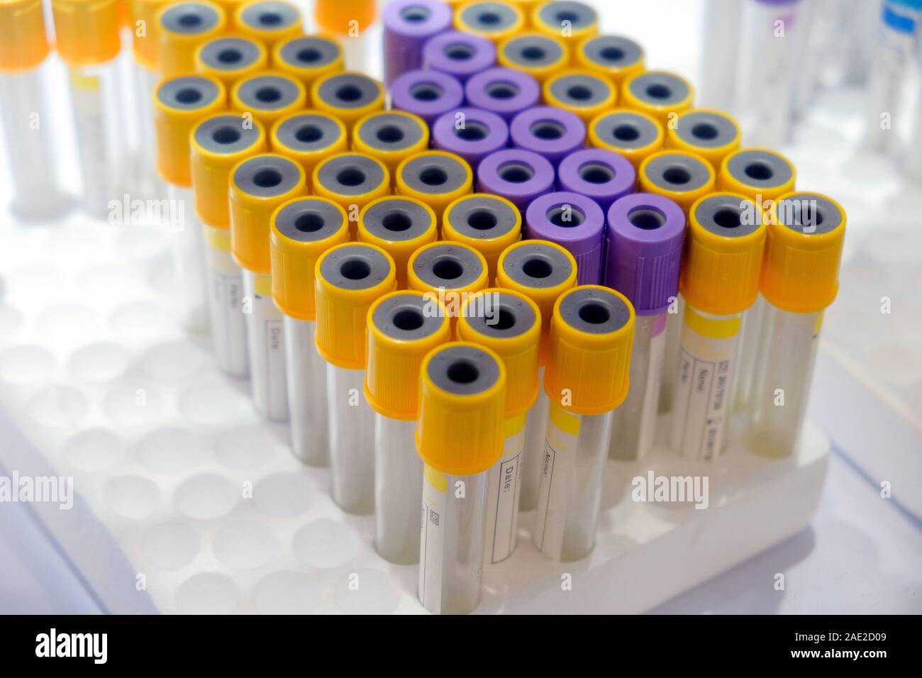 Medizinischen probe -Fotos und -Bildmaterial in hoher Auflösung – Alamy