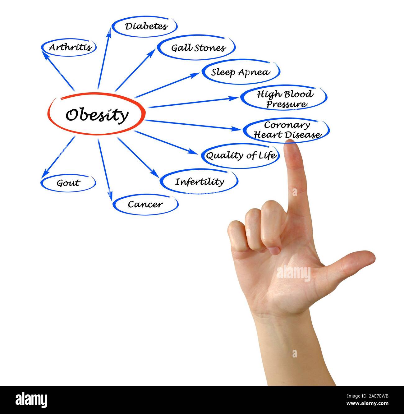 Diagramm der Adipositas Stockfotografie - Alamy