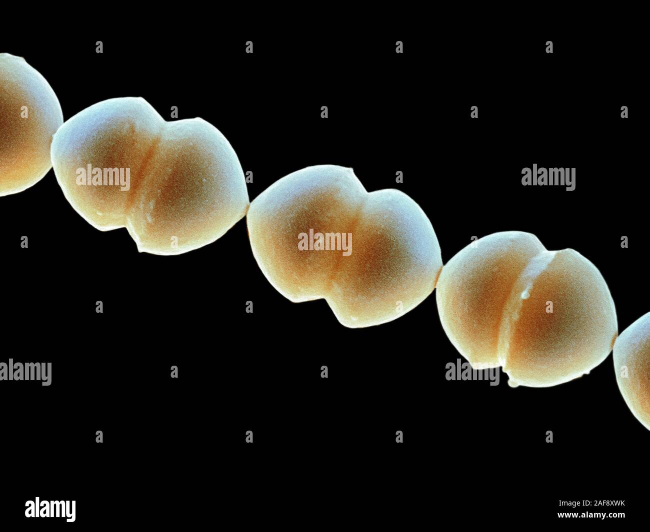Streptococcus faecalis -Fotos und -Bildmaterial in hoher Auflösung – Alamy