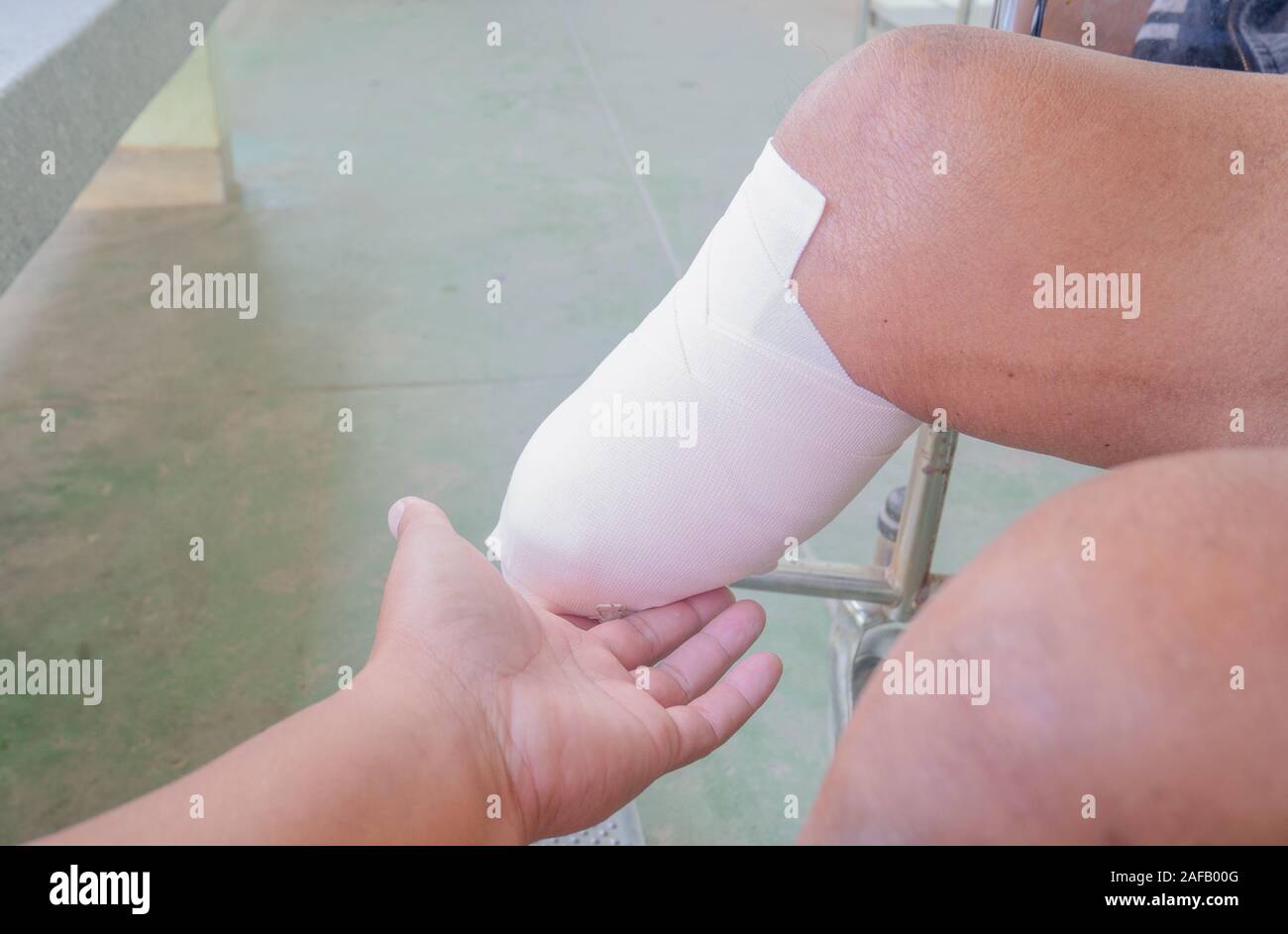 Knee amputation -Fotos und -Bildmaterial in hoher Auflösung – Alamy
