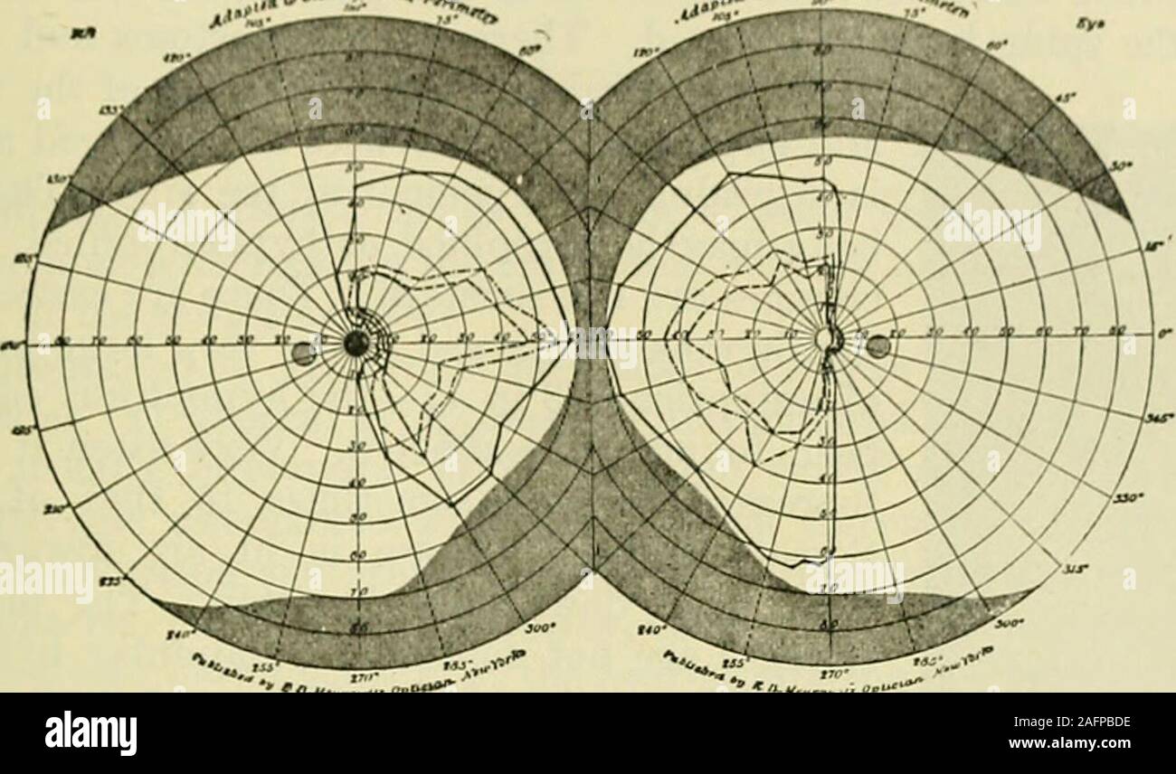 Adiposis dolorosa -Fotos und -Bildmaterial in hoher Auflösung – Alamy