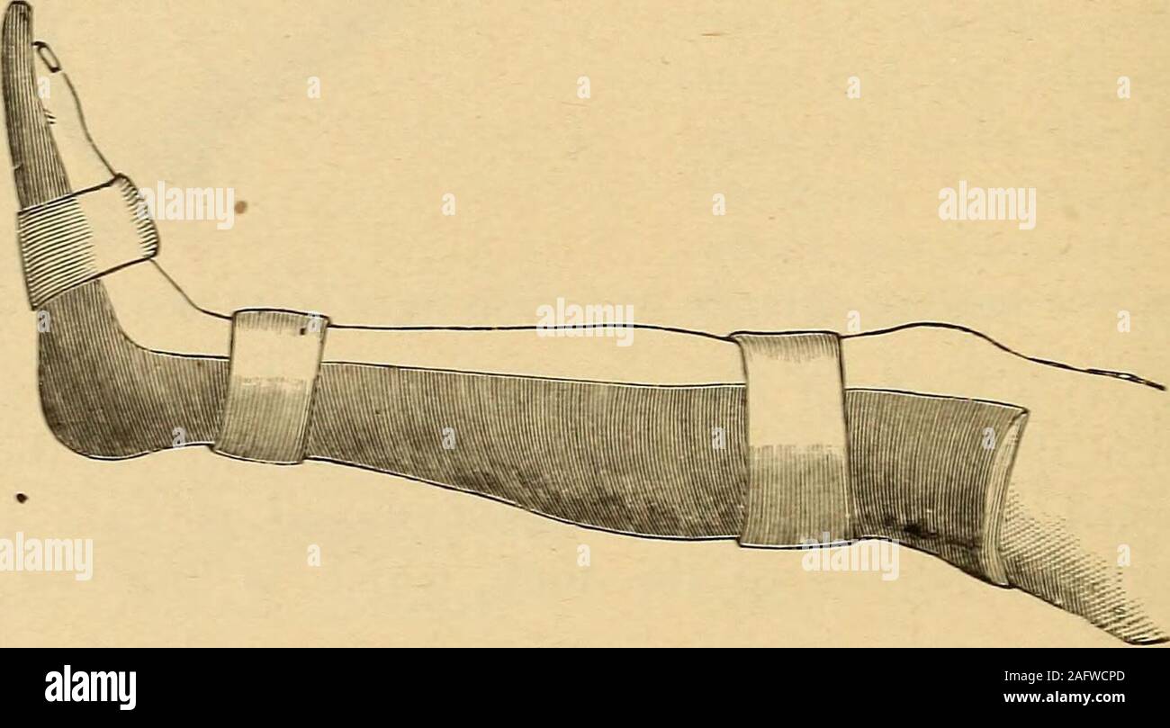 . Eine praktische Abhandlung über Brüche und Verwerfungen. Kann ...