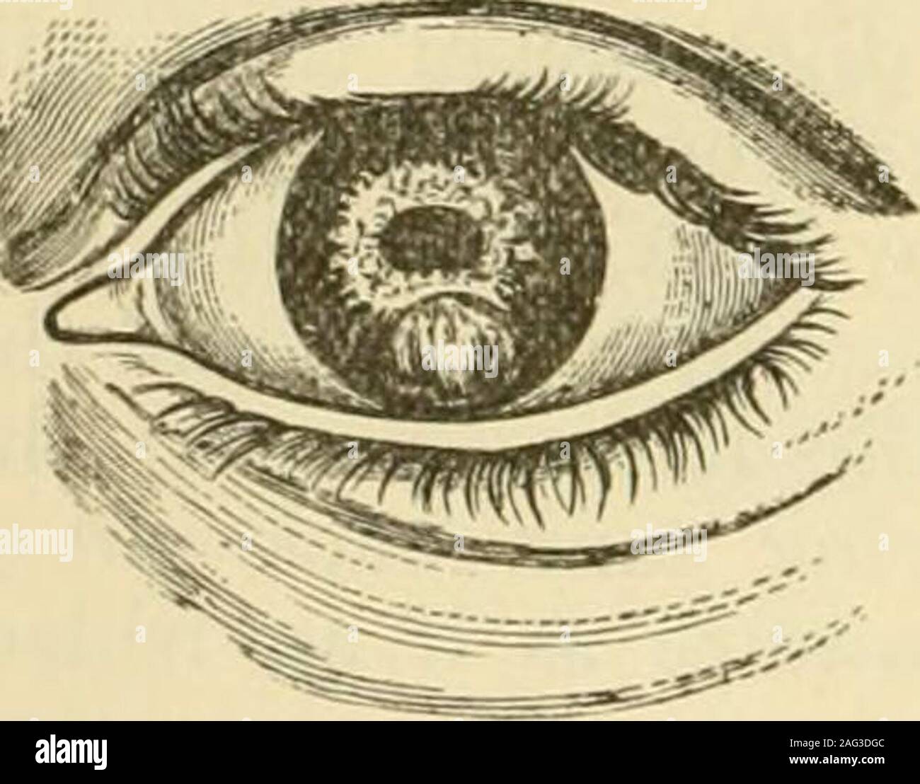 Talgzyste auge -Fotos und -Bildmaterial in hoher Auflösung – Alamy
