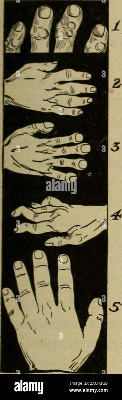 Stigmata hands -Fotos und -Bildmaterial in hoher Auflösung – Alamy