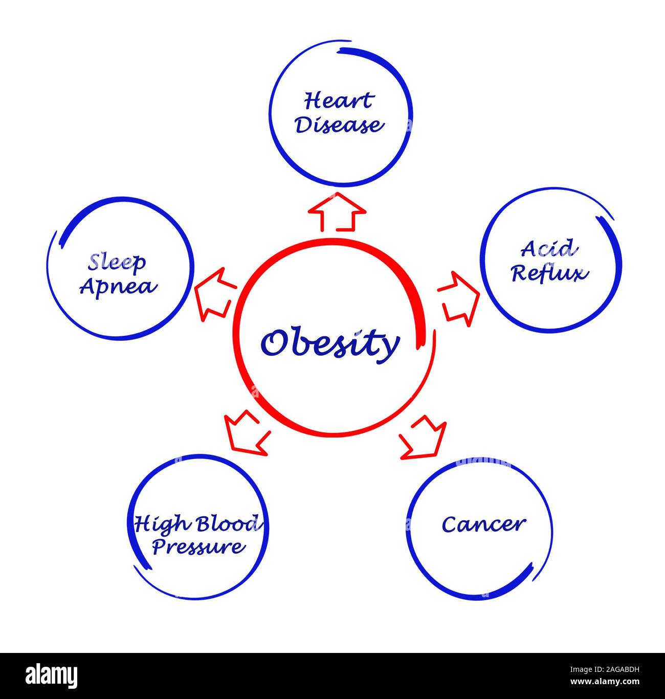 Fettleibigkeit diagramm Ausgeschnittene Stockfotos und -bilder - Alamy