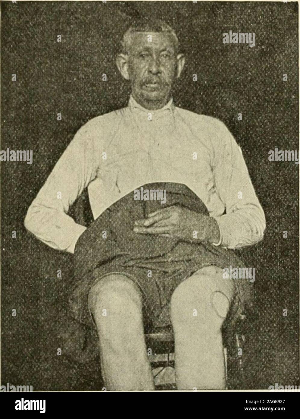 Innerer kondylus -Fotos und -Bildmaterial in hoher Auflösung – Alamy