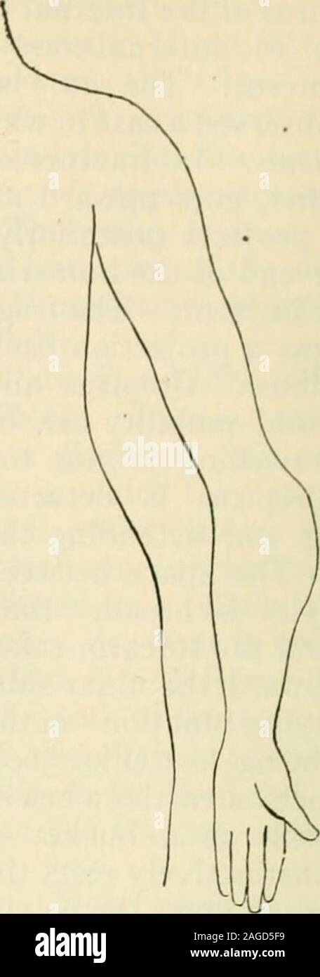 Inner condyle -Fotos und -Bildmaterial in hoher Auflösung – Alamy