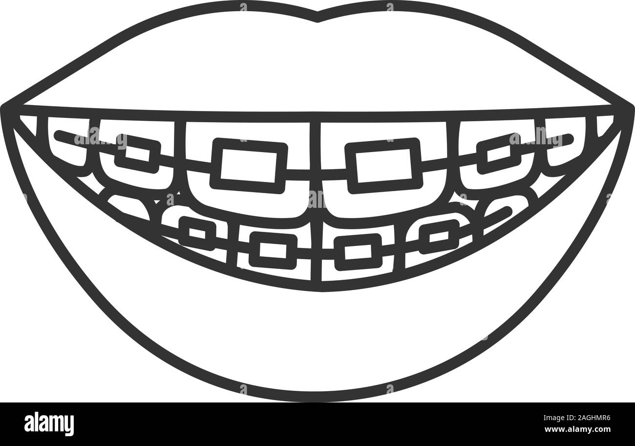 Zahnspangen lineare Symbol. Dünne Linie Abbildung. Zähne ausrichten ... Zahnspangen lineare Symbol. Dünne Linie Abbildung. Zähne ausrichten ...