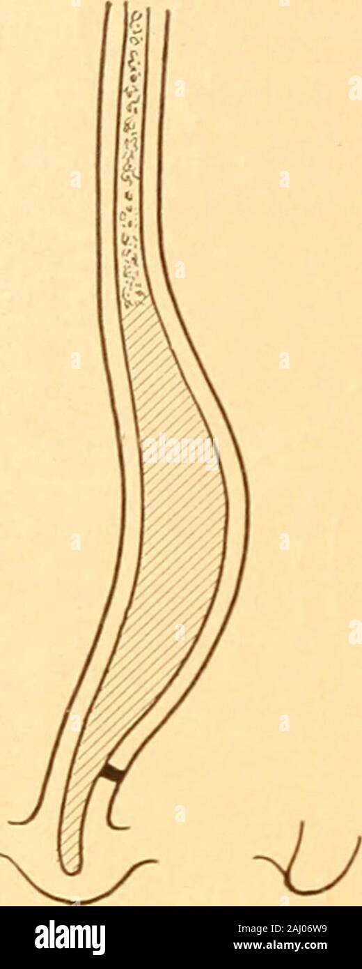 Ein Handbuch von Erkrankungen der Nase und des Rachens. t bis auf die ...