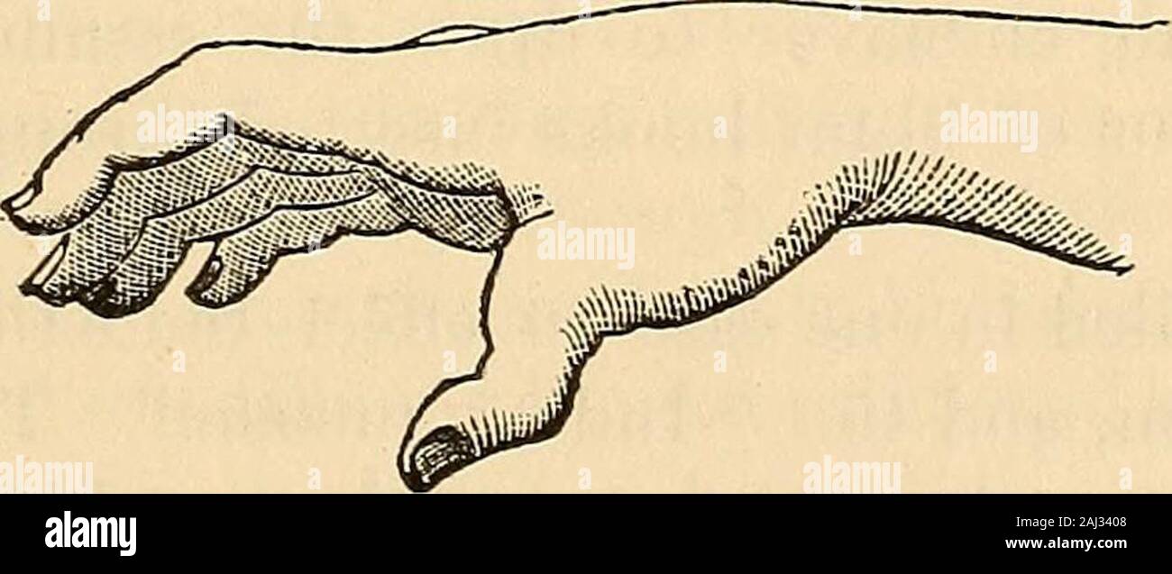 Endglieder der hand -Fotos und -Bildmaterial in hoher Auflösung – Alamy