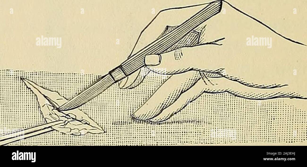 Operative Chirurgie. Abb. 36. Halten Sie das Messer, die zweite ...