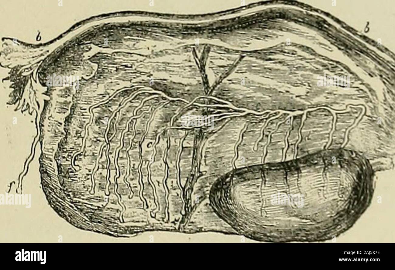 Hermaphroditismus beim Menschen. irum. Ich Irclhrnc ich Pars ...