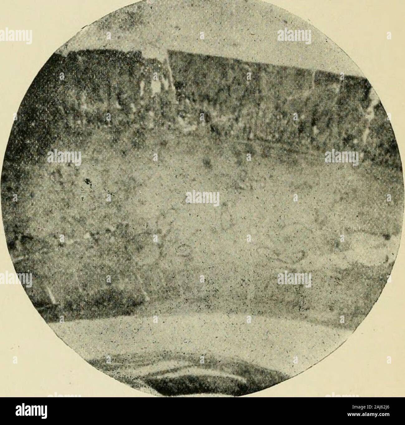 Einige Punkte in der Anatomie, Pathologie und Chirurgie der ...