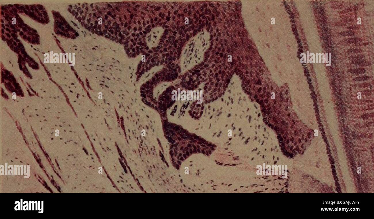 Eosin y -Fotos und -Bildmaterial in hoher Auflösung – Alamy