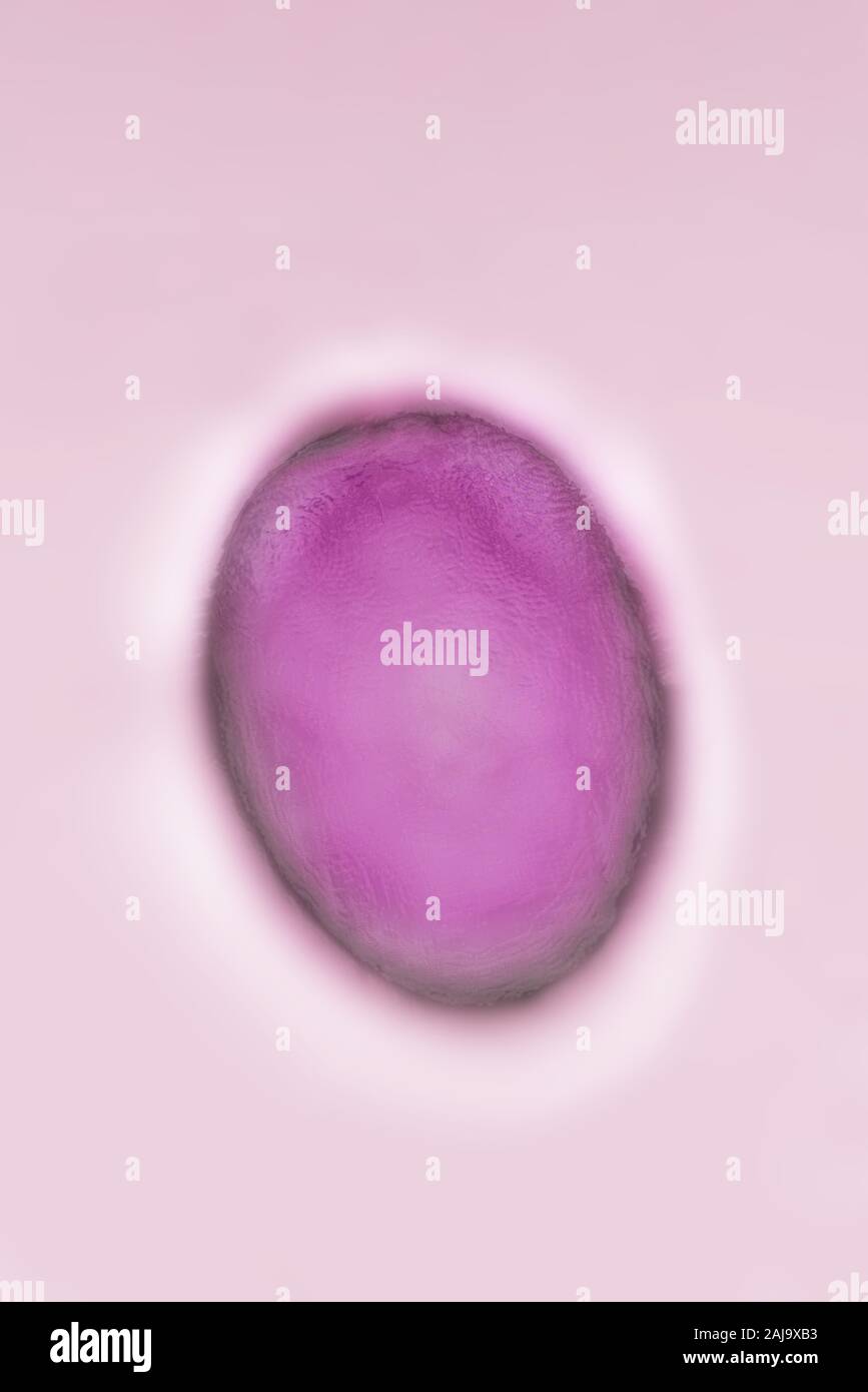 Candida infektion -Fotos und -Bildmaterial in hoher Auflösung – Alamy