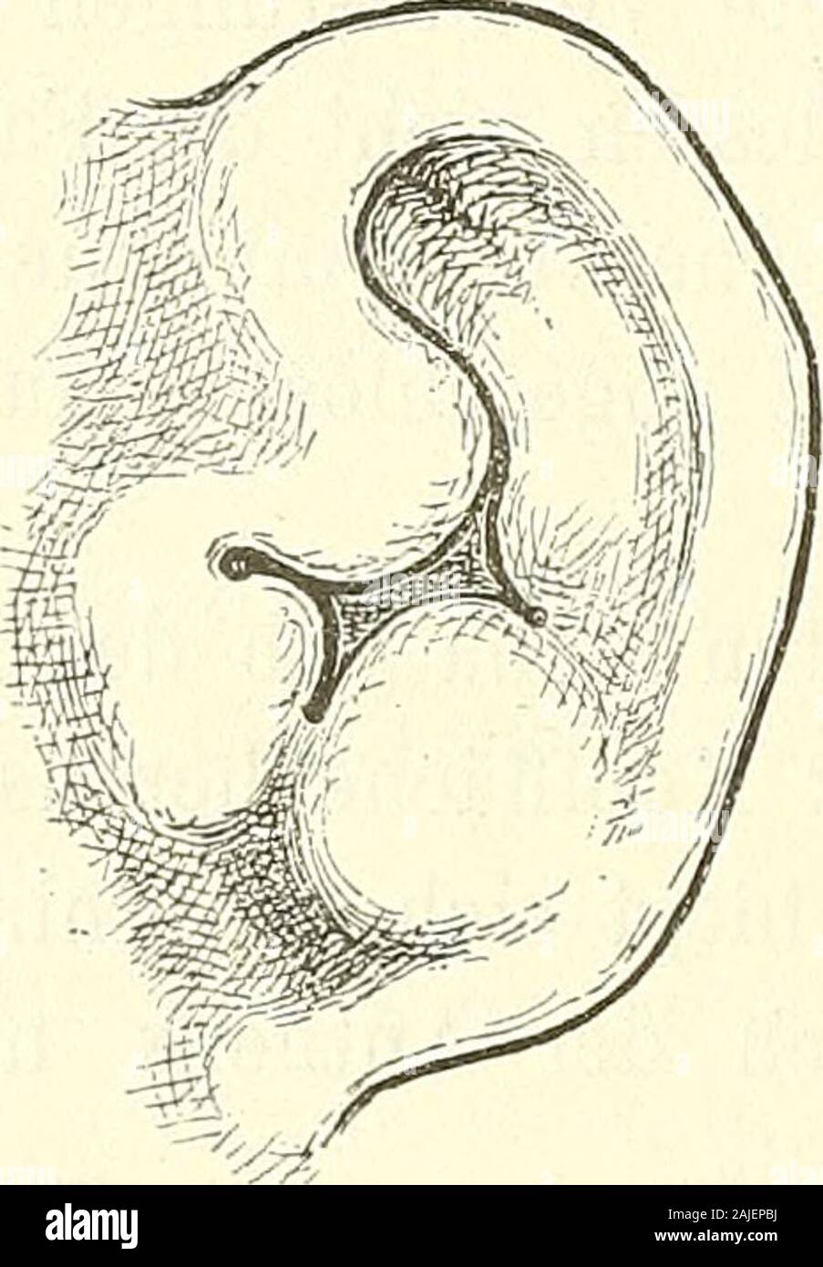 Fossa triangularis -Fotos und -Bildmaterial in hoher Auflösung – Alamy
