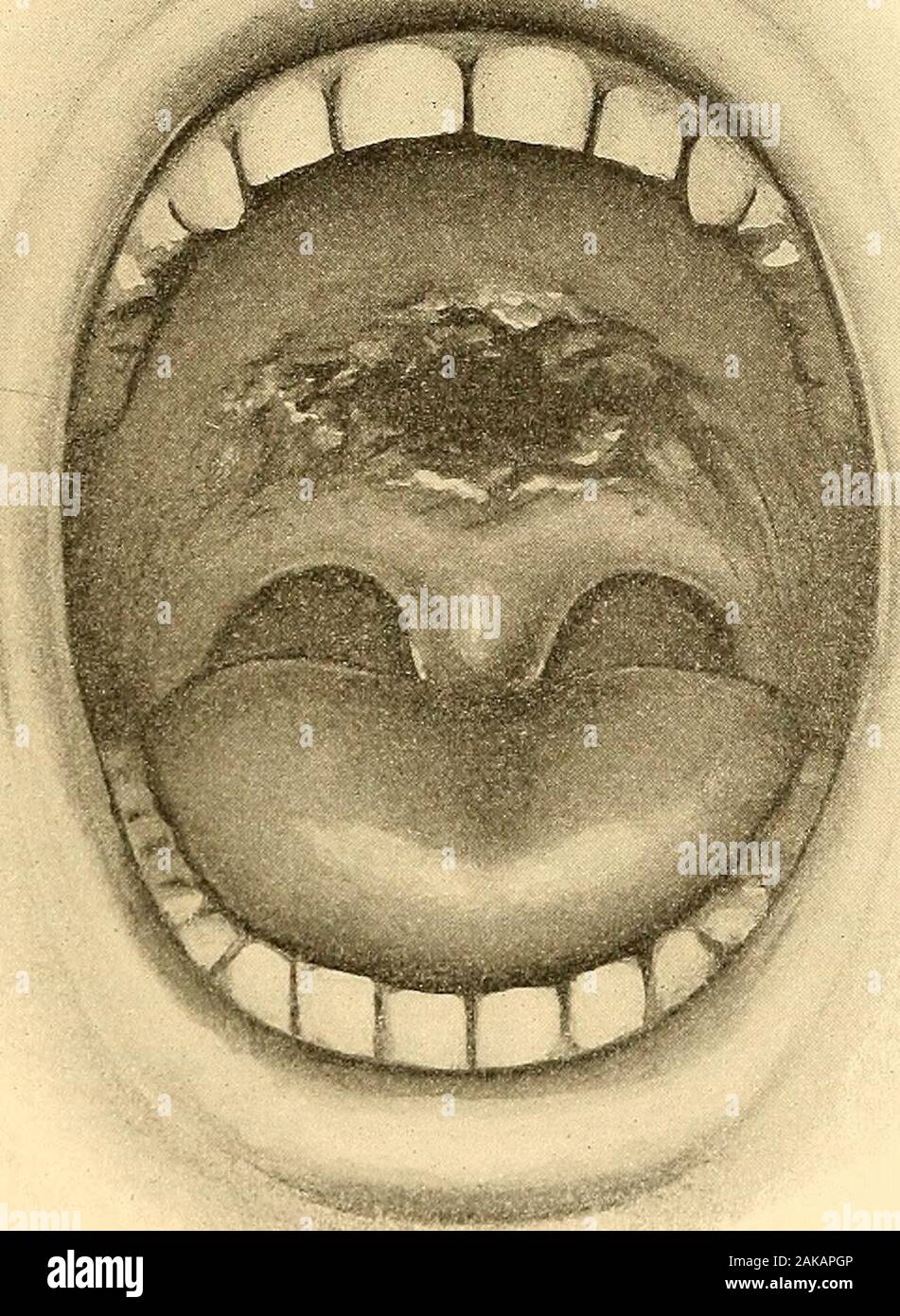 Beruhigen den hals -Fotos und -Bildmaterial in hoher Auflösung – Alamy