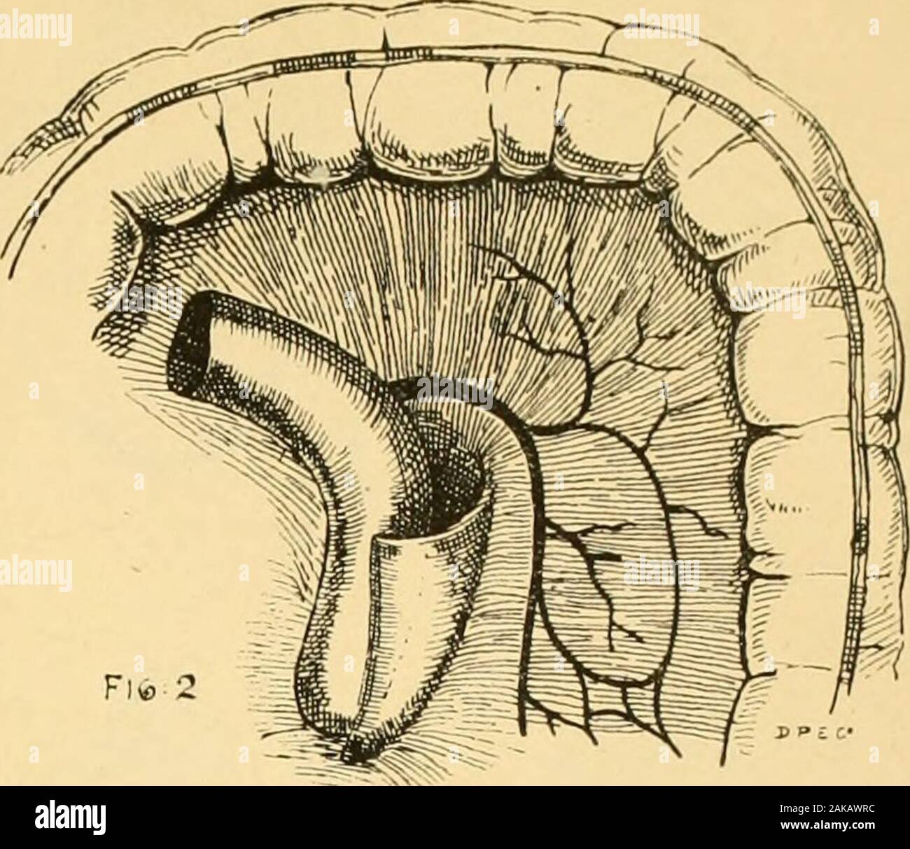 Die Anatomie des Darmkanals und Bauchfell im Menschen Stockfotografie ...