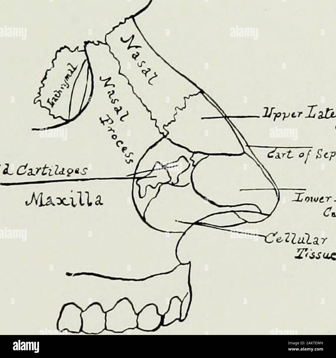 Nasal fracture -Fotos und -Bildmaterial in hoher Auflösung – Alamy