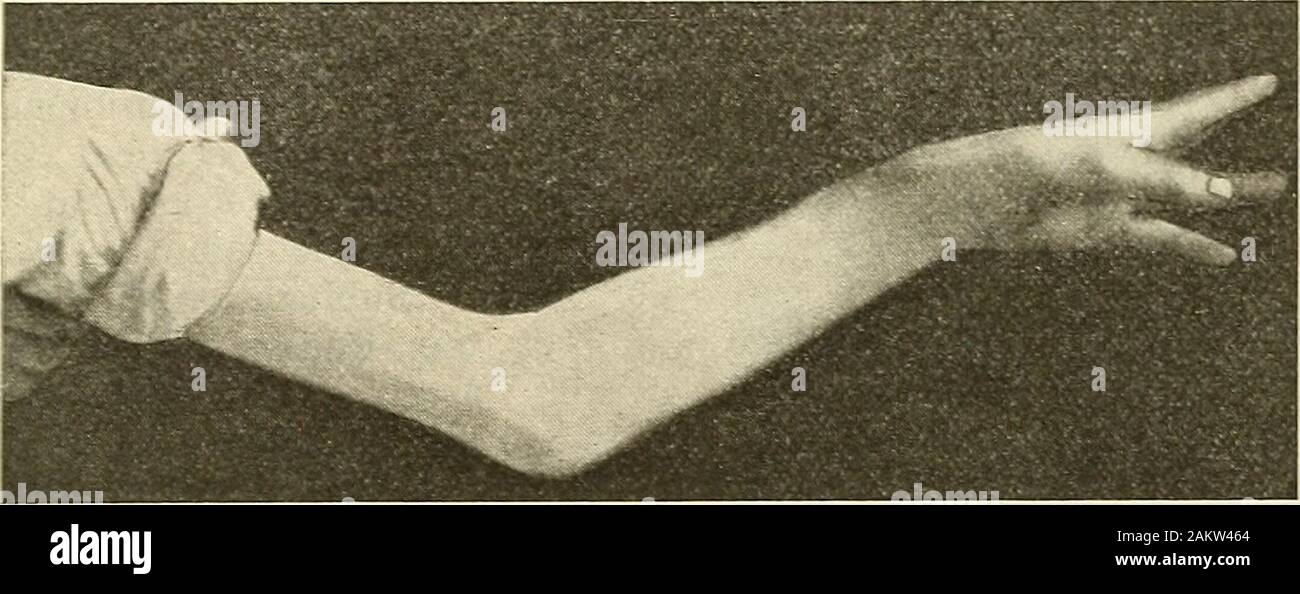 Innerer kondylus -Fotos und -Bildmaterial in hoher Auflösung – Alamy