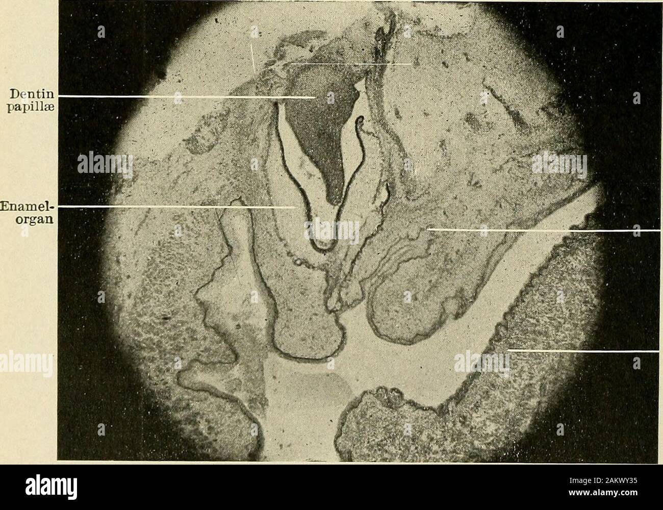 Grundsätze und Praxis der Operative Zahnheilkunde. Follikel von Laub ...