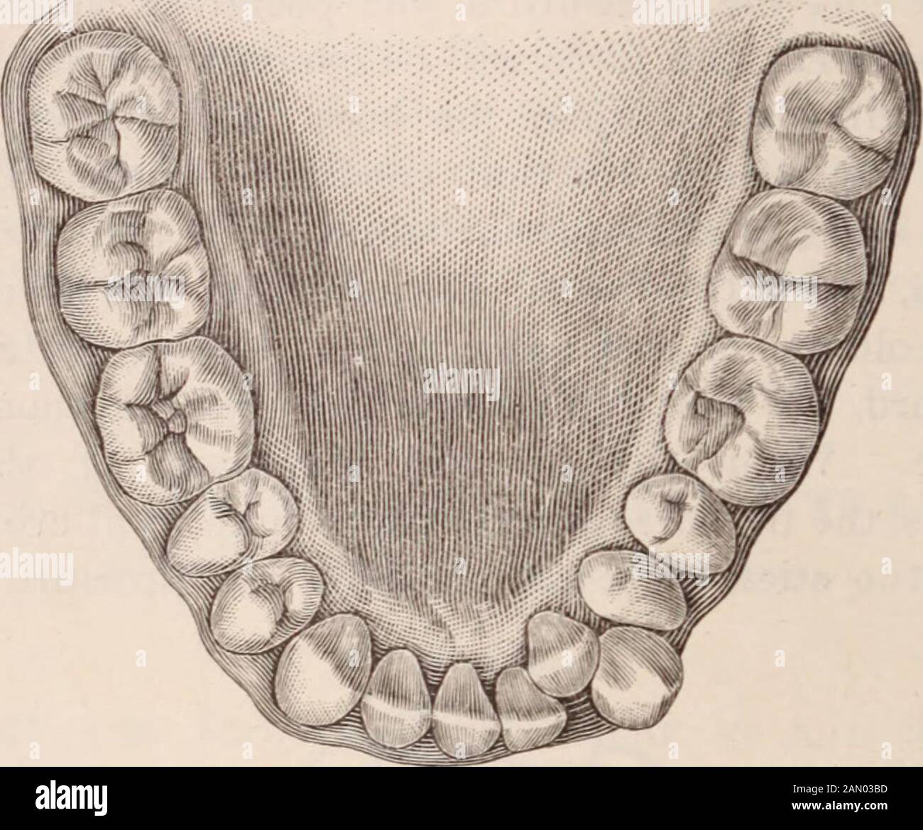 Lateral Incisor Stockfotos und -bilder Kaufen - Alamy