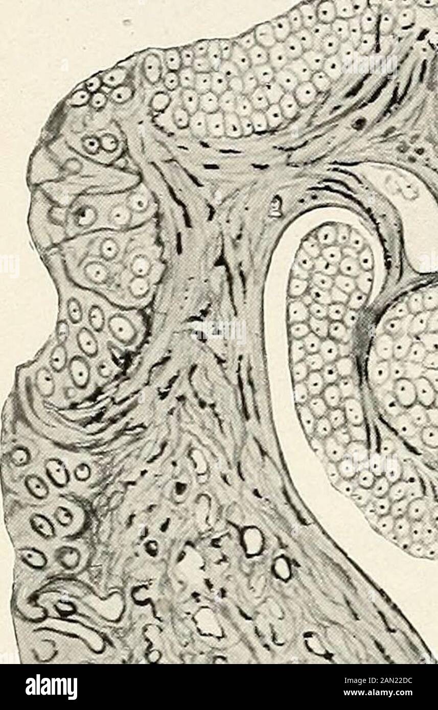 Follikuläre zyste -Fotos und -Bildmaterial in hoher Auflösung – Alamy