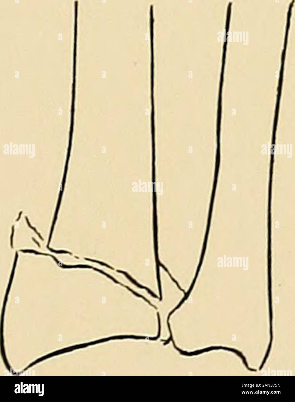 Processus styloideus der ulna -Fotos und -Bildmaterial in hoher ...