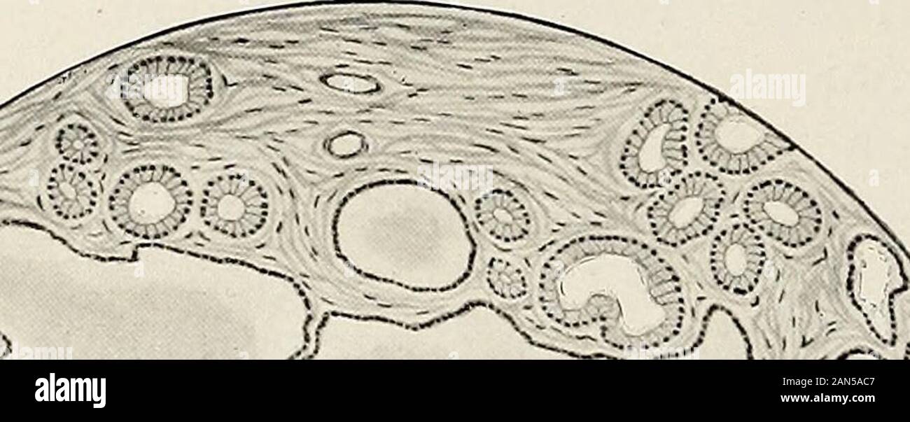 Infected cyst -Fotos und -Bildmaterial in hoher Auflösung – Alamy