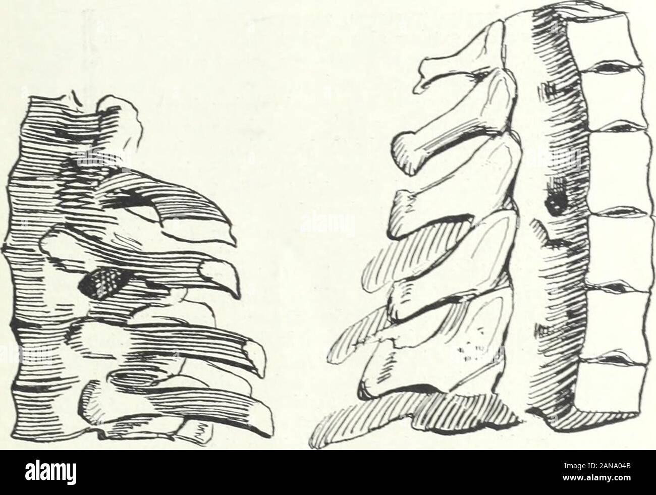 Maryland medical journal. Die bullet entdeckt. Der Dura war weit ...