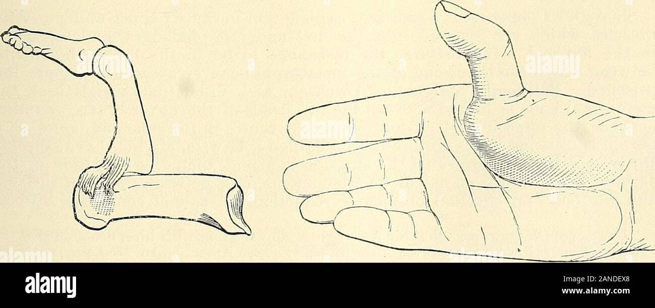 Flexion dorsale -Fotos und -Bildmaterial in hoher Auflösung – Alamy