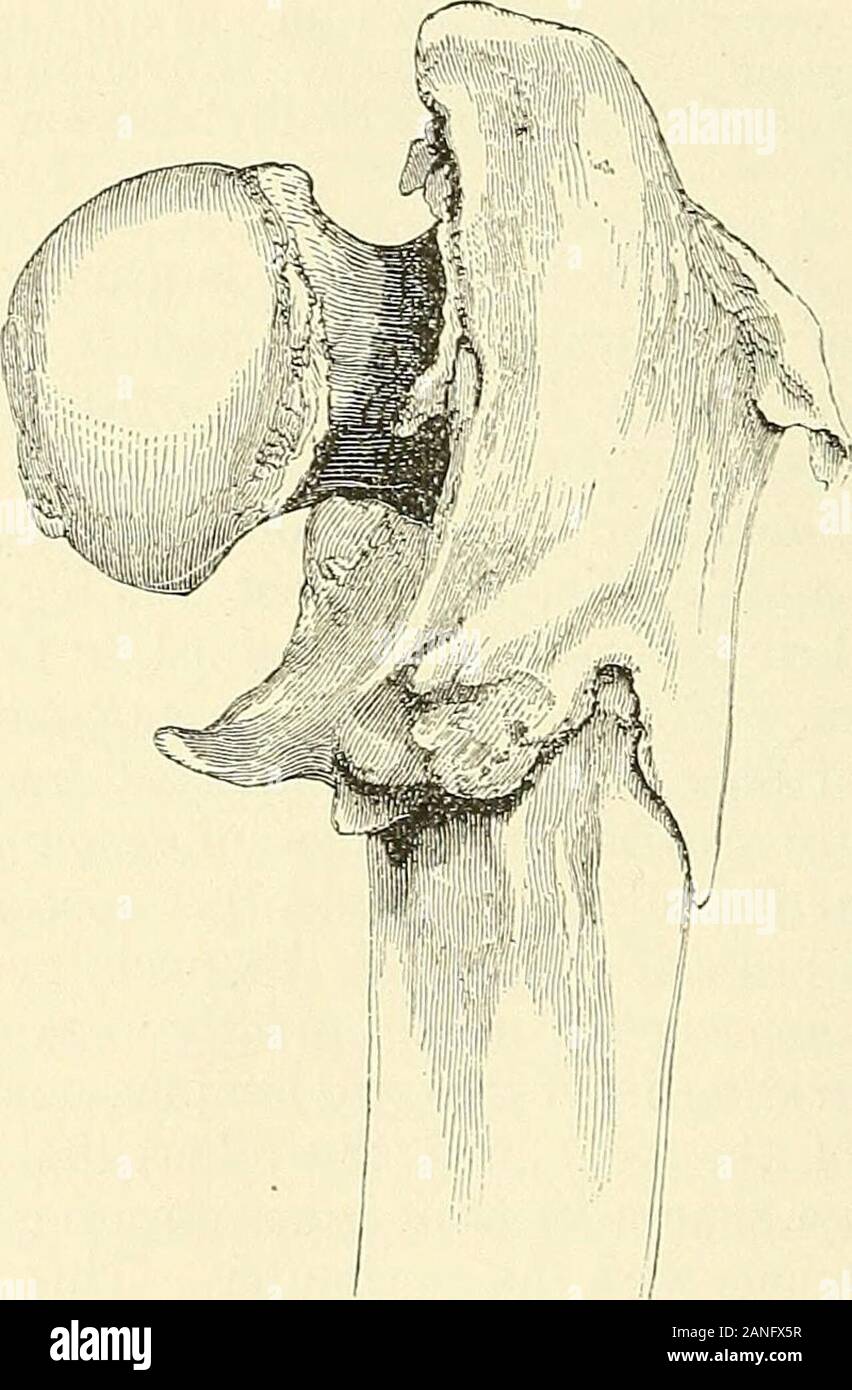 Eine praktische Abhandlung über Brüche und Verwerfungen. Oper, von B ...