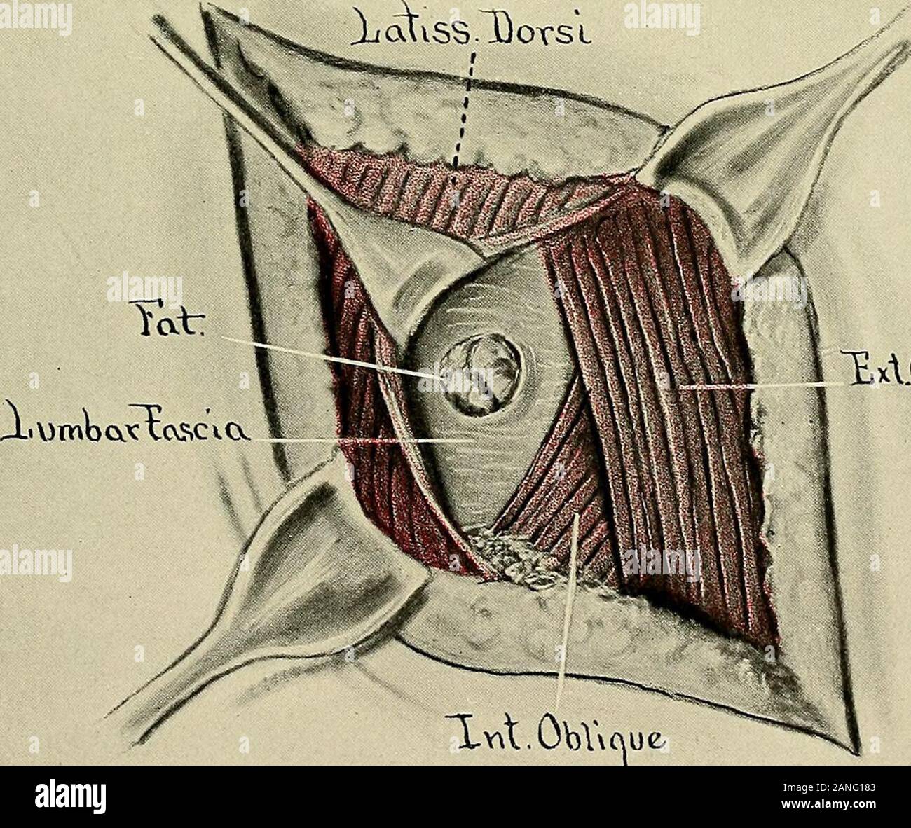 Gynäkologie. Abb. 391.- Aussetzung der Niere. Exposition der Latissimus ...