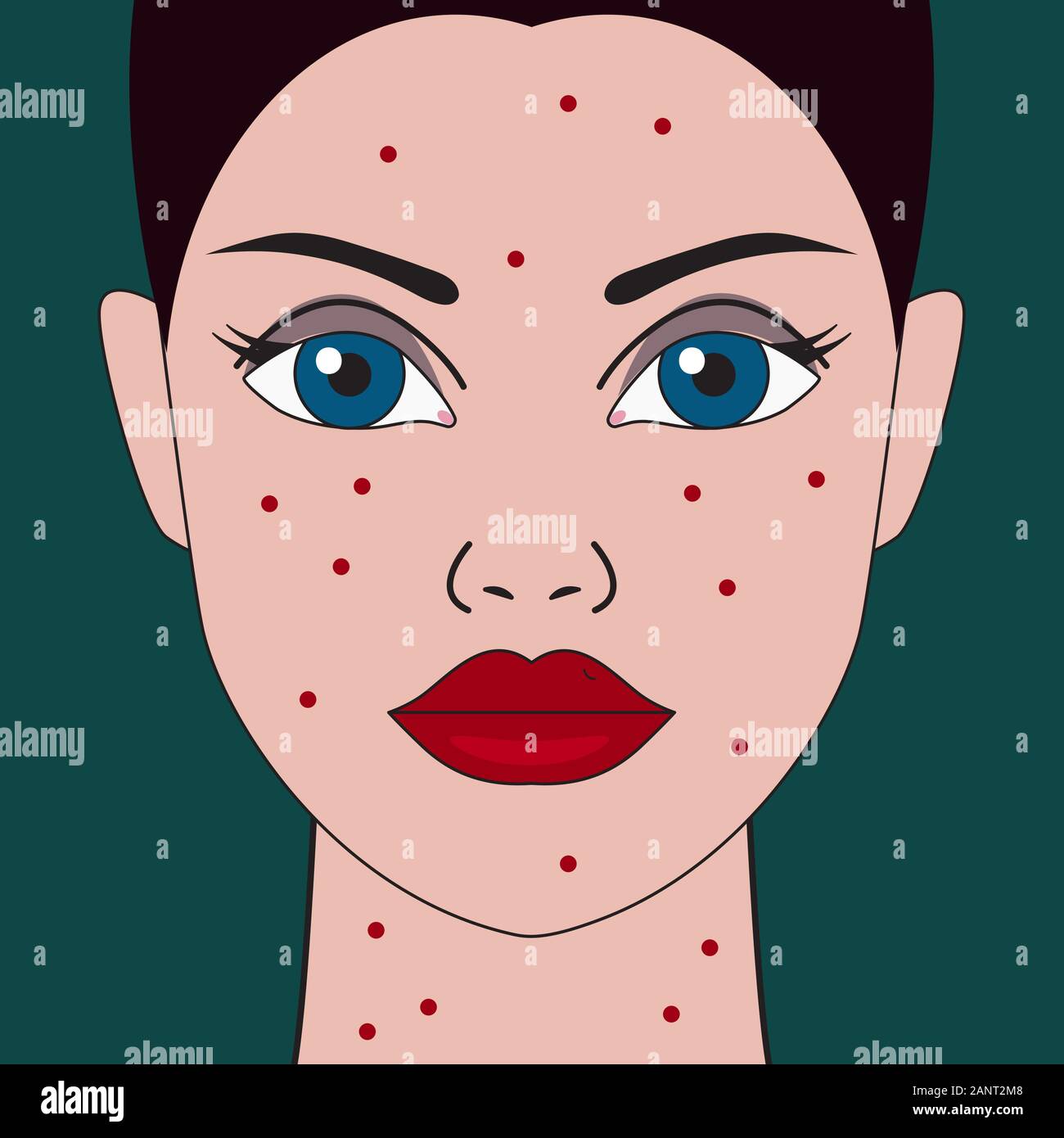 Roter hautausschlag mensch Stock-Vektorgrafiken kaufen - Alamy